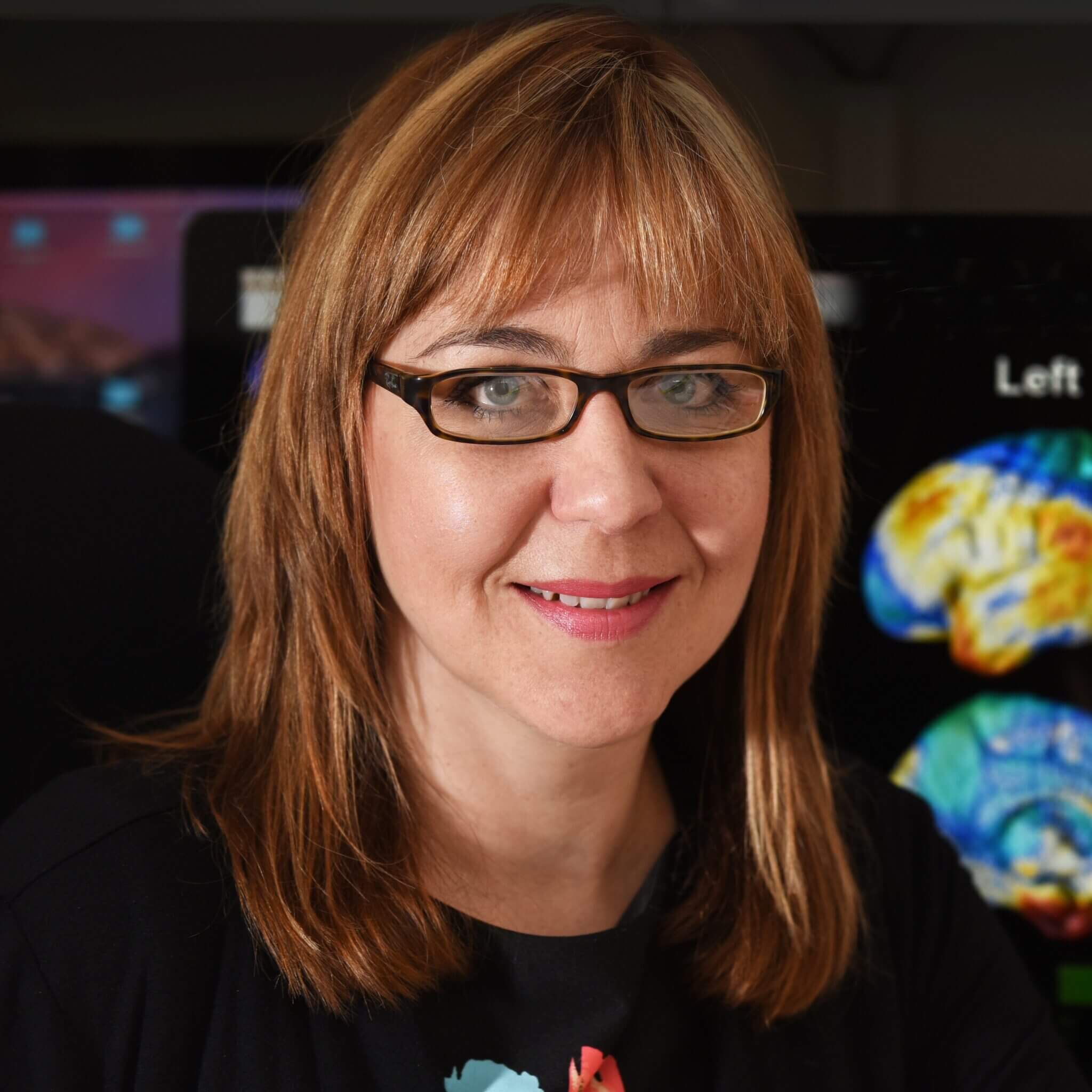 Liana G. Apostolova, MD, MSc, FAAN - Alzheimer's Clinical Trials ...